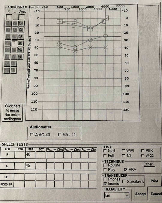 Solved What type and configuration of hearing loss does | Chegg.com