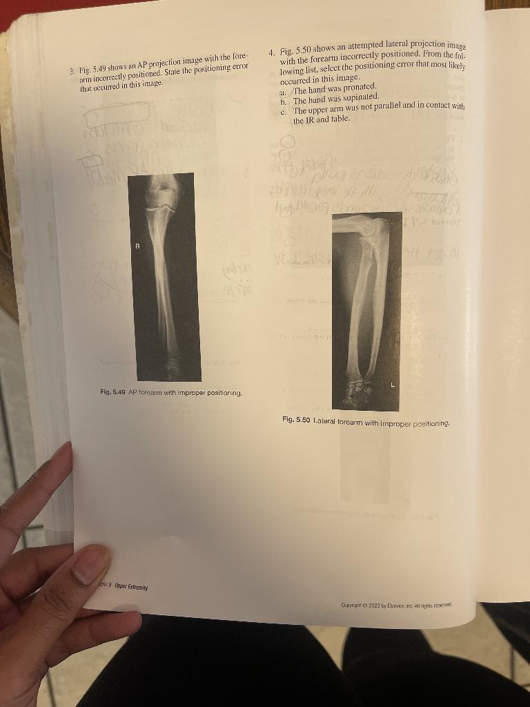 Solved 3. Fig. 5.49 shows an AP projection image with the | Chegg.com