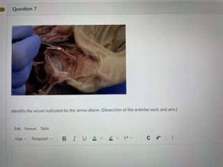 Solved Identify the vessel indicated by the arrow above. | Chegg.com
