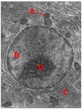 Solved The TEM image below show the structure of the cells. | Chegg.com