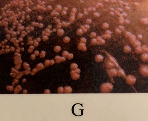 Solved The bacterial growth pattern on agar slant Tube D is | Chegg.com