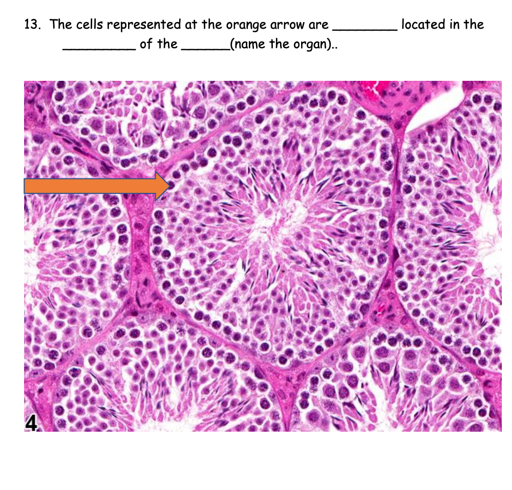 Solved located in the 13. The cells represented at the | Chegg.com