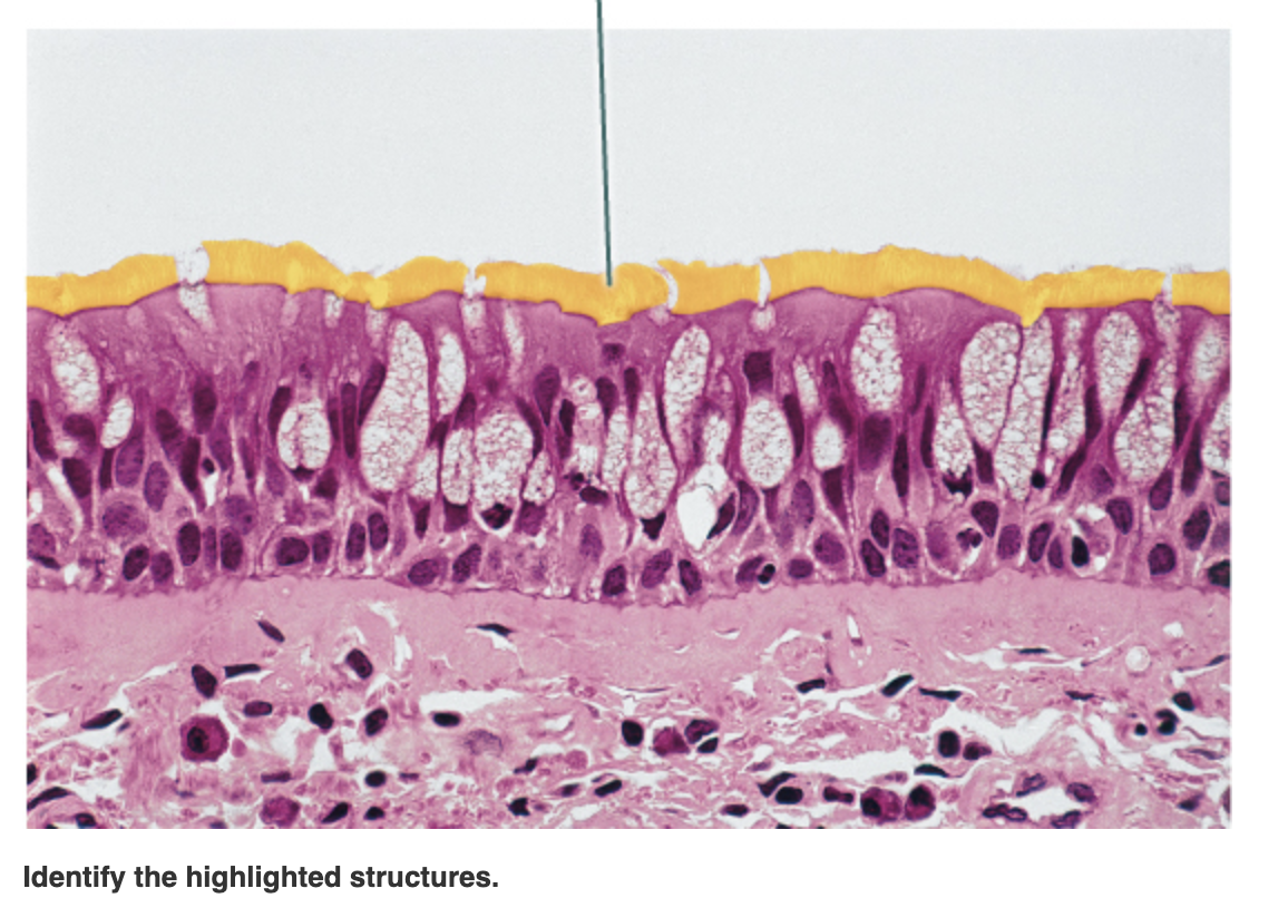 Solved Identify the highlighted structures. | Chegg.com