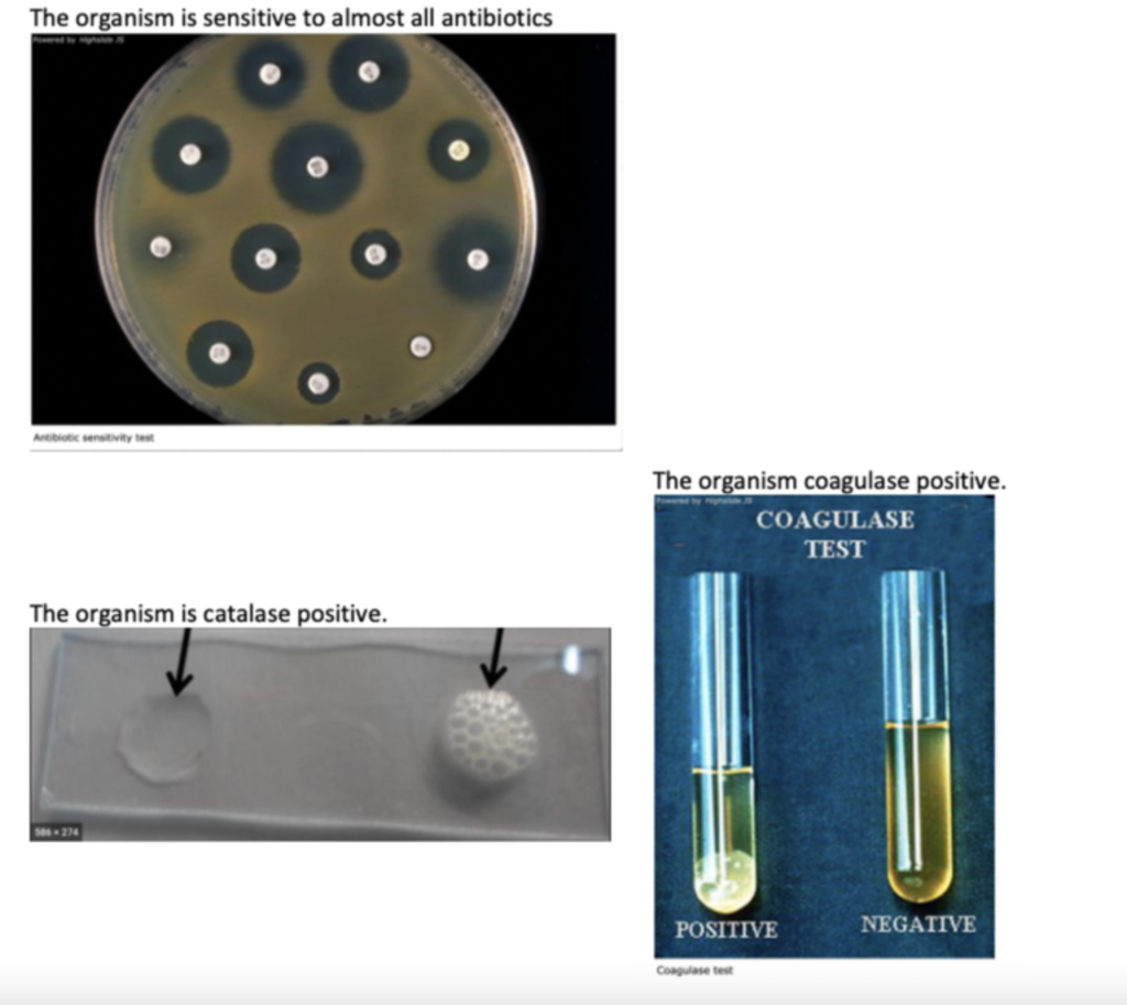 Solved Clinical history: In just a week, my 7 -year old | Chegg.com