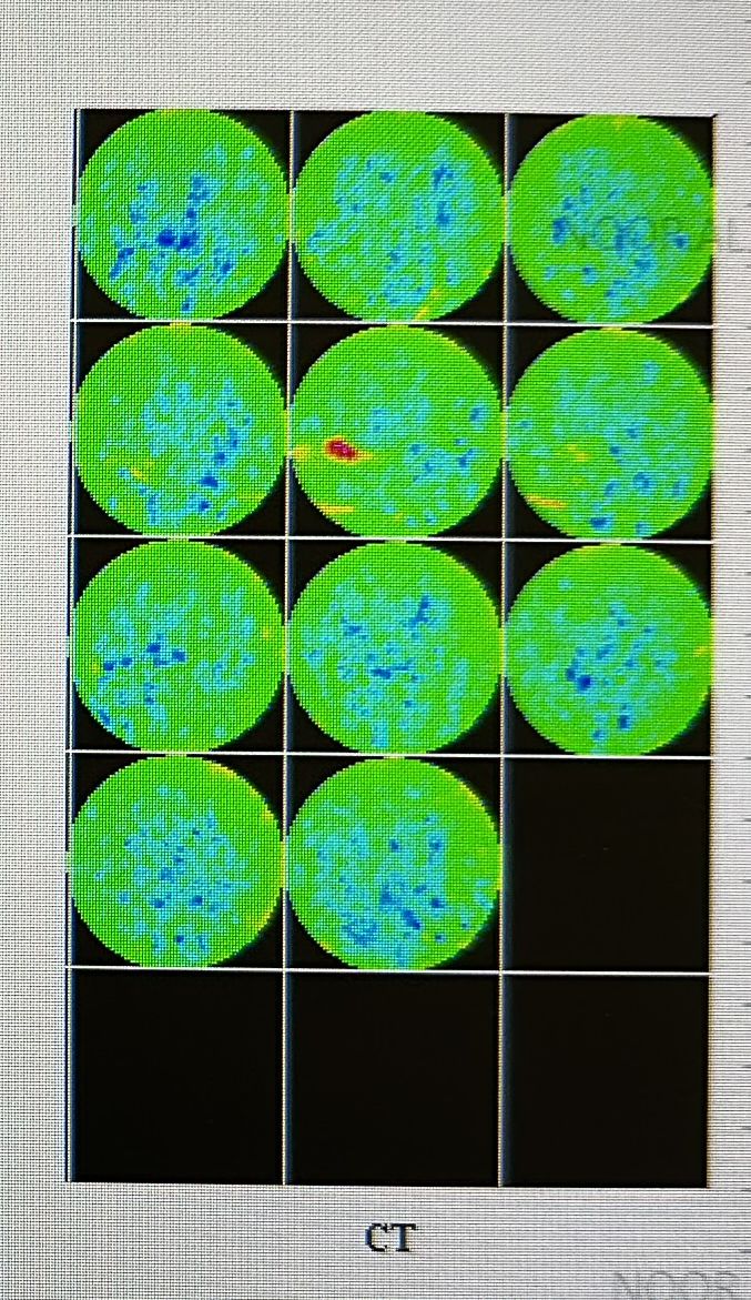 Solved function cropped_images_stack = | Chegg.com