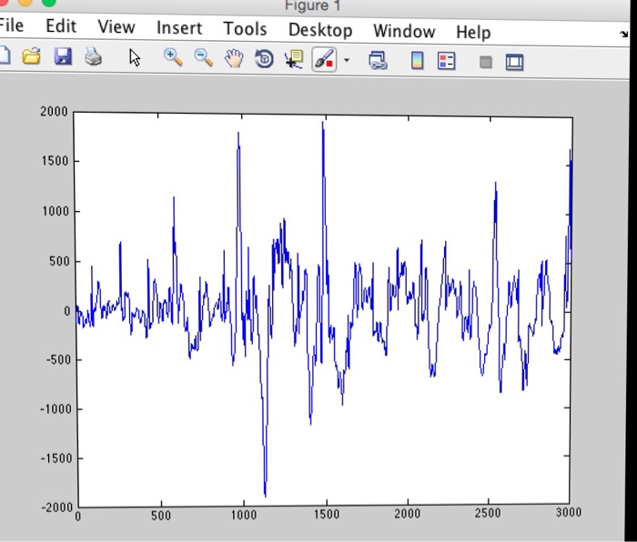Solved Identify the source of noise artifact in the | Chegg.com