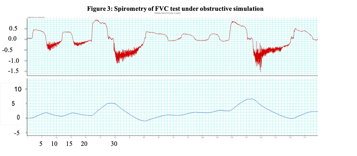 Solved Figure 3: Spirometry of FVC test under obstructive | Chegg.com