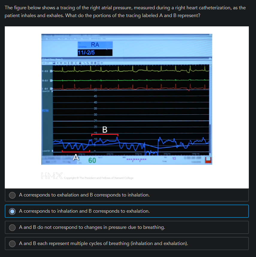 Solved The figure below shows a tracing of the right atrial | Chegg.com