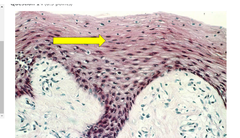 Solved Simple Squamous Epithelium Simple Cuboidal | Chegg.com