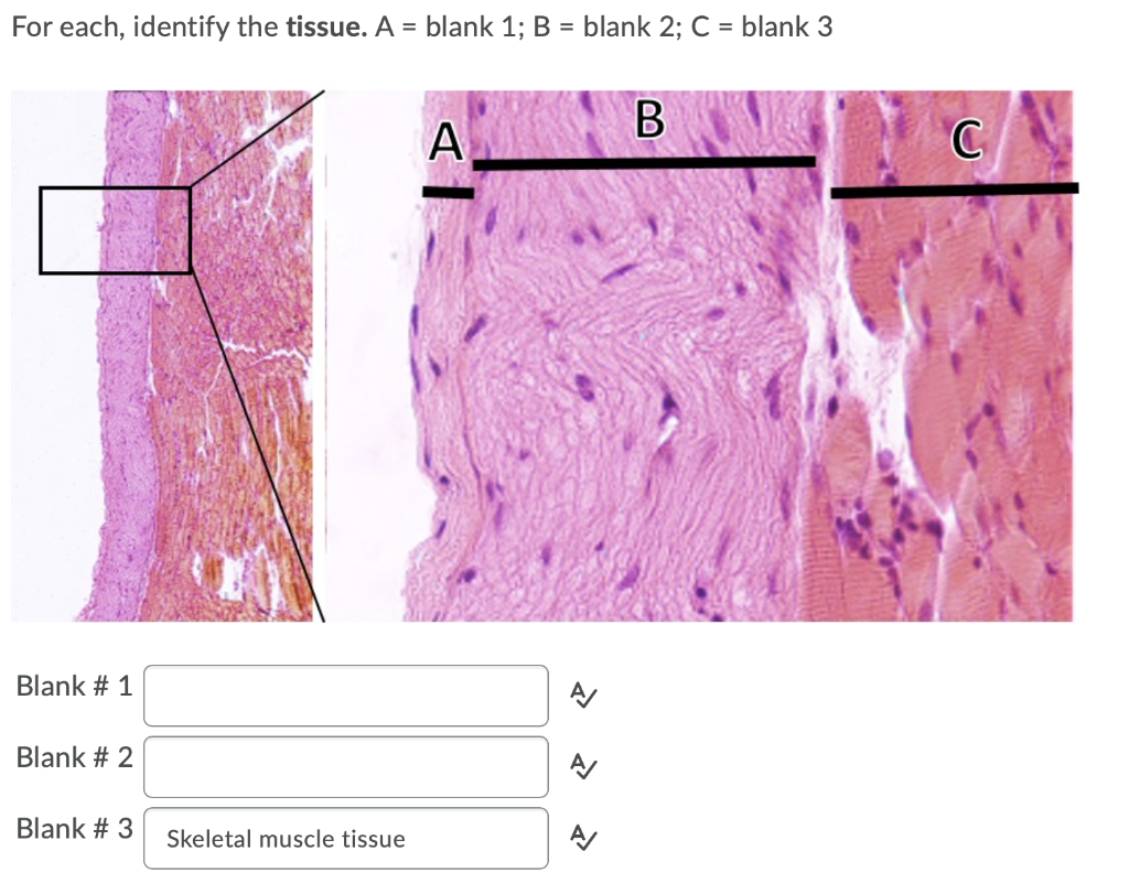 Solved For each, identify the tissue. A = blank 1; B = blank | Chegg.com