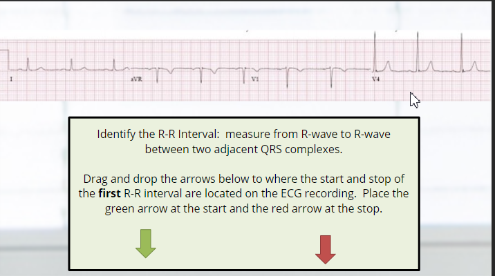 1 VR VE V4 Identify the R-R Interval: measure from | Chegg.com