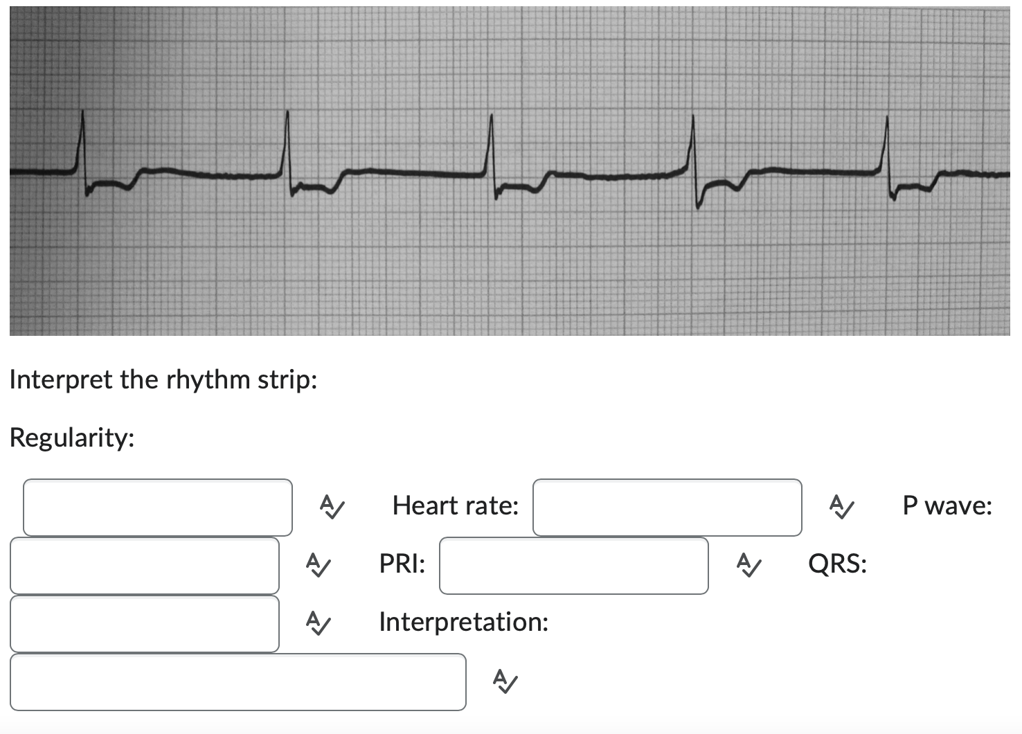 Solved Interpret the rhythm strip:Regularity:Heart rate:P | Chegg.com