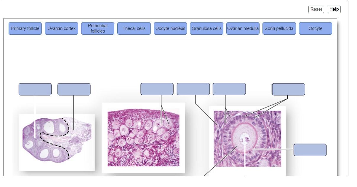 Solved Primary follicle Ovarian cortex Primordial Thecal | Chegg.com