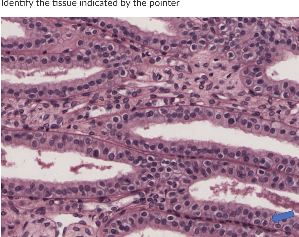 Solved Identify the tissue indicated by the pointer | Chegg.com