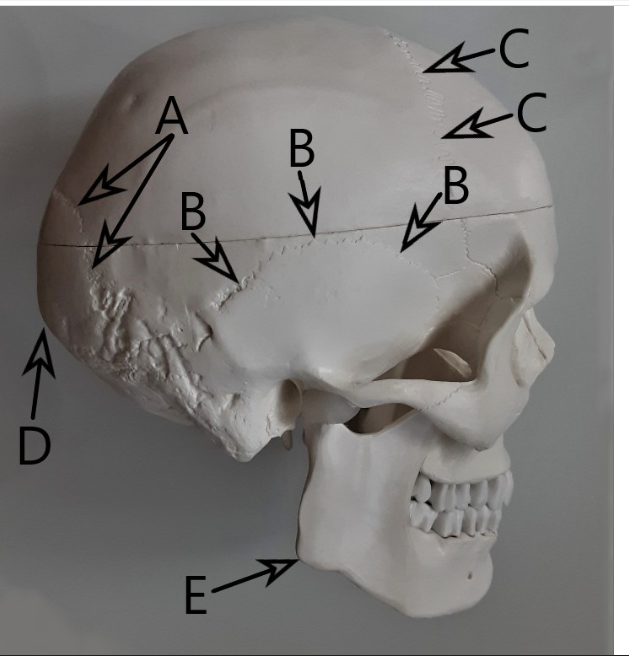 Solved 1.The projection "A" is [ Select ] ["zygomatic | Chegg.com