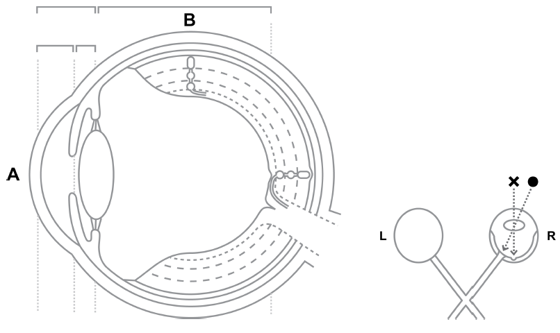 Solved Pathway of nervous signal transmission after a photon | Chegg.com