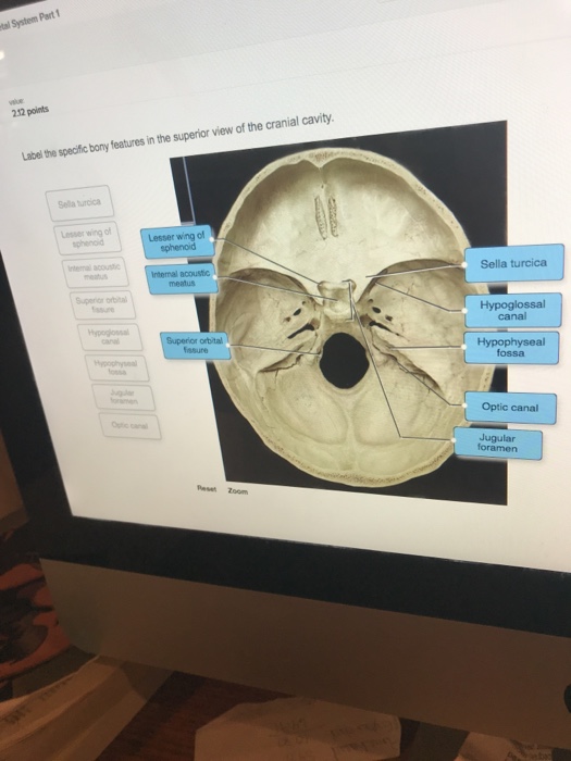 Solved tal System Part 1 212 points Label the specitic bony | Chegg.com