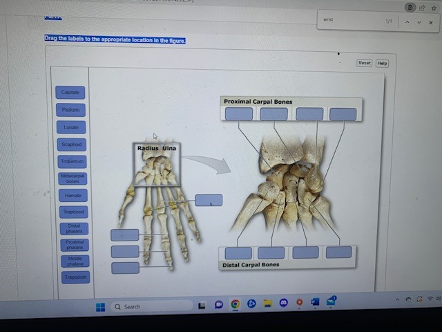 Solved Art-labeling Activity: Bones of the Wrist and Hand. | Chegg.com