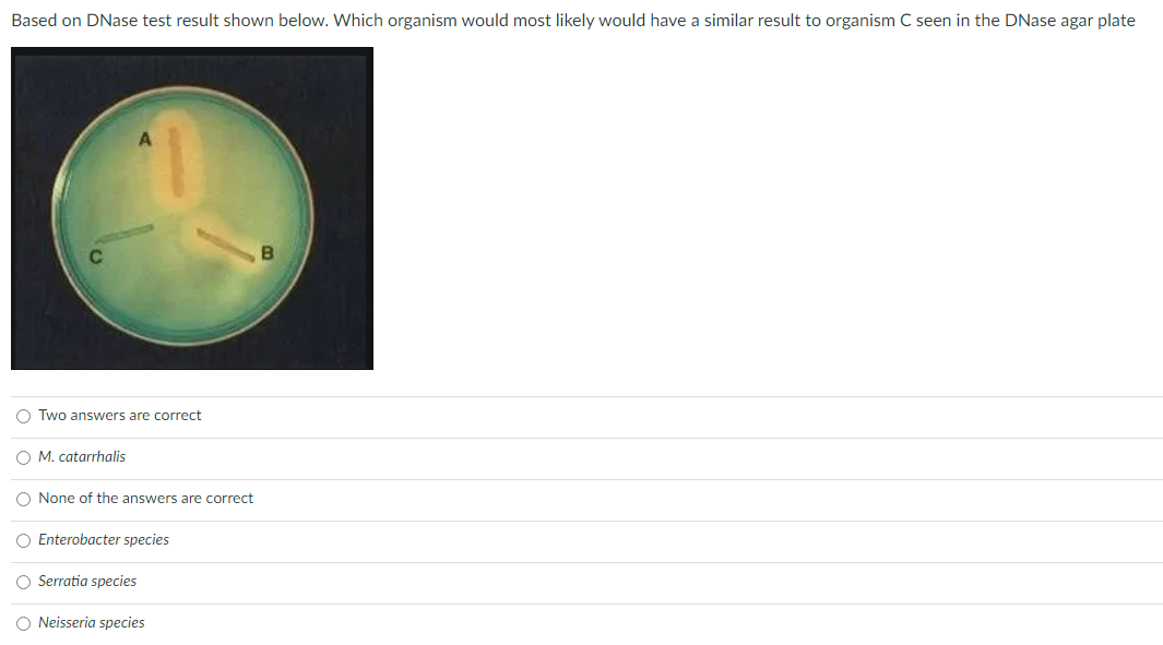 Solved Based on DNase test result shown below. Which | Chegg.com