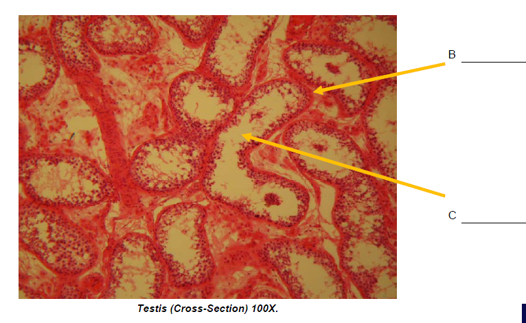 Solved Testis (Cross-Section) 100X. | Chegg.com