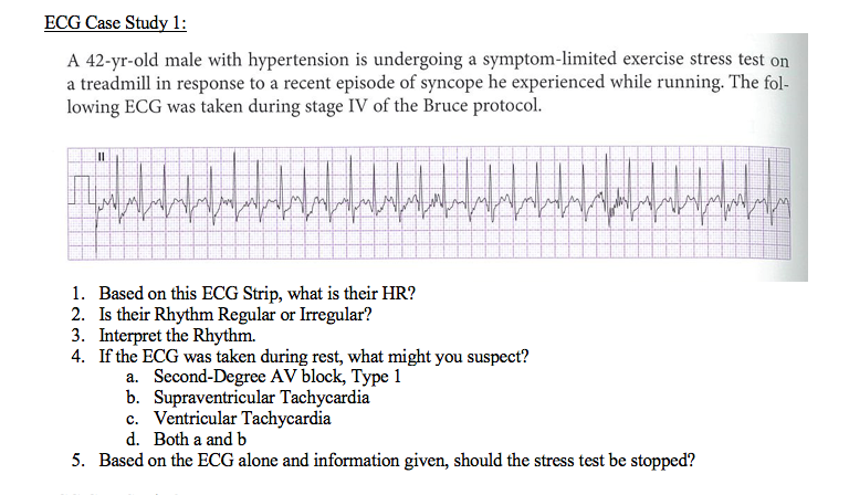 Solved ECG Case Study 1: A 42-yr-old male with hypertension | Chegg.com