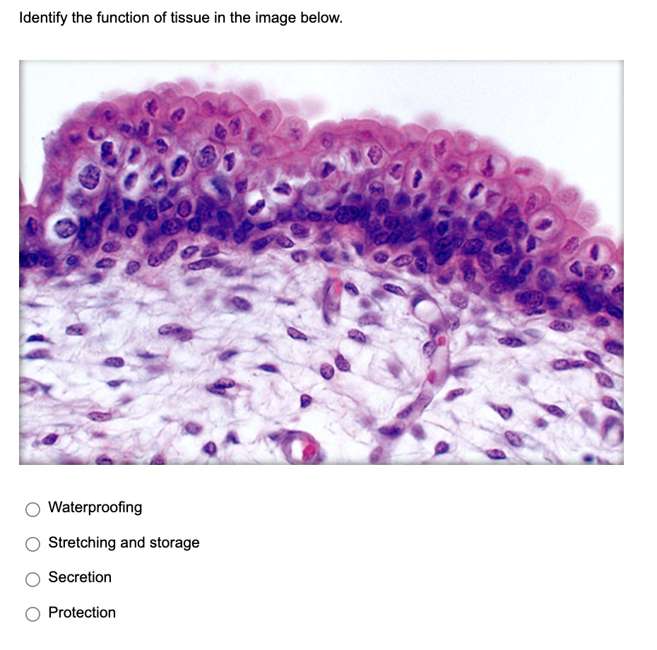 Solved Identify the function of tissue in the image below. | Chegg.com