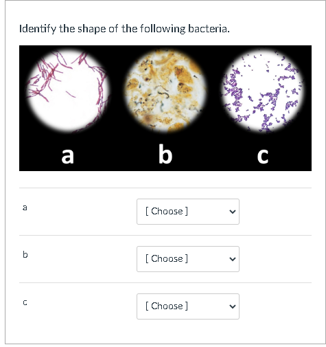 Solved Identify the shape of the following bacteria. | Chegg.com