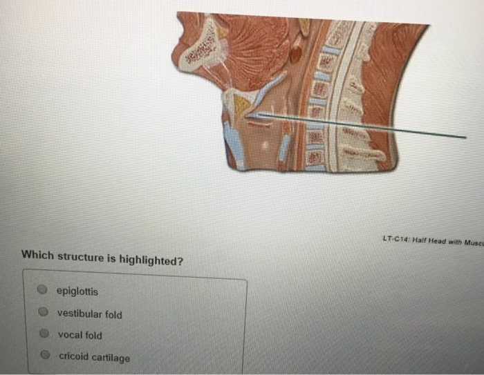 Solved LT-C14 Haif Head with Musculature.30 The highlighted | Chegg.com