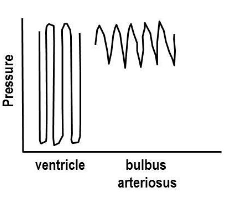 [Solved]: The figure at right illustrates pressures in the v