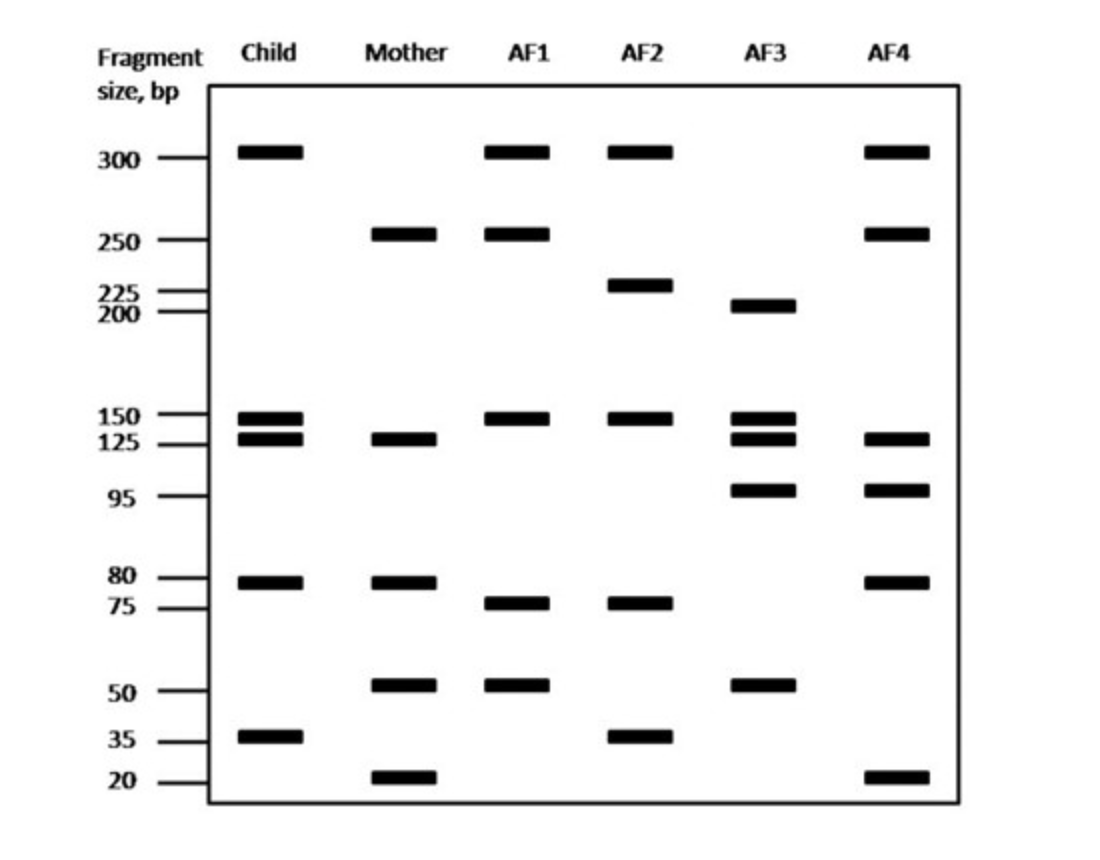 Solved Select the restriction fragment band sizes in the | Chegg.com
