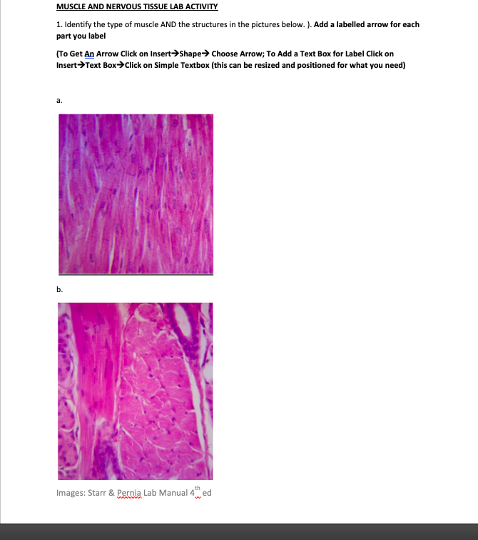 Solved MUSCLE AND NERVOUS TISSUE LAB ACTIVITY 1. Identify | Chegg.com
