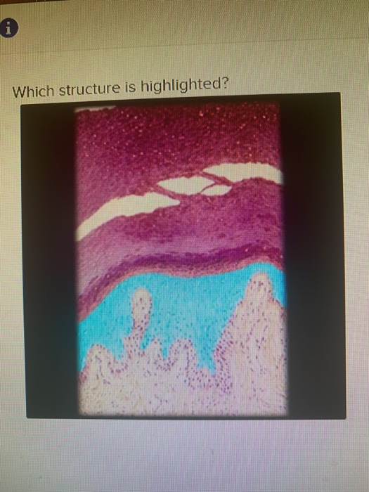 Which structure is highlighted? Multiple Choice | Chegg.com