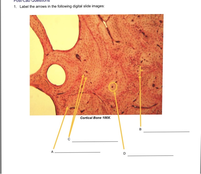 Solved Label the of the corticle bone? Label A,b,c | Chegg.com