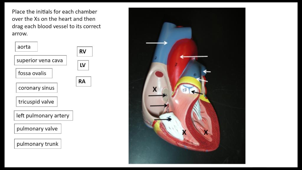 Solved Ch 18 Lab activity 1: Review of heart anatomy | Chegg.com