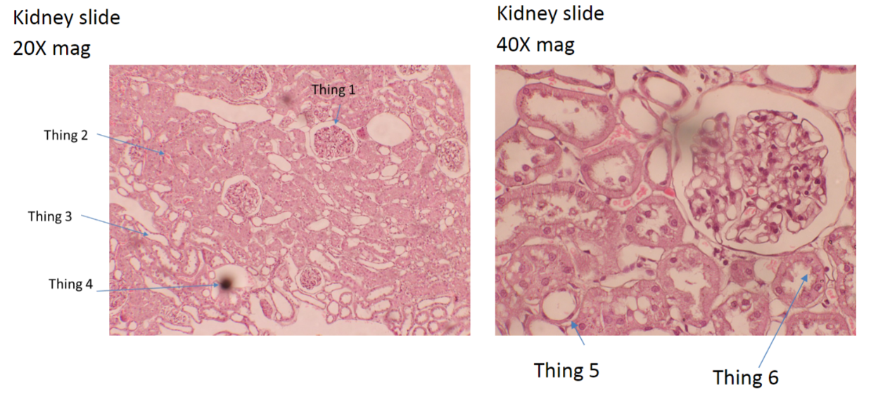Solved For each “Thing” (feature) described on the slide at | Chegg.com