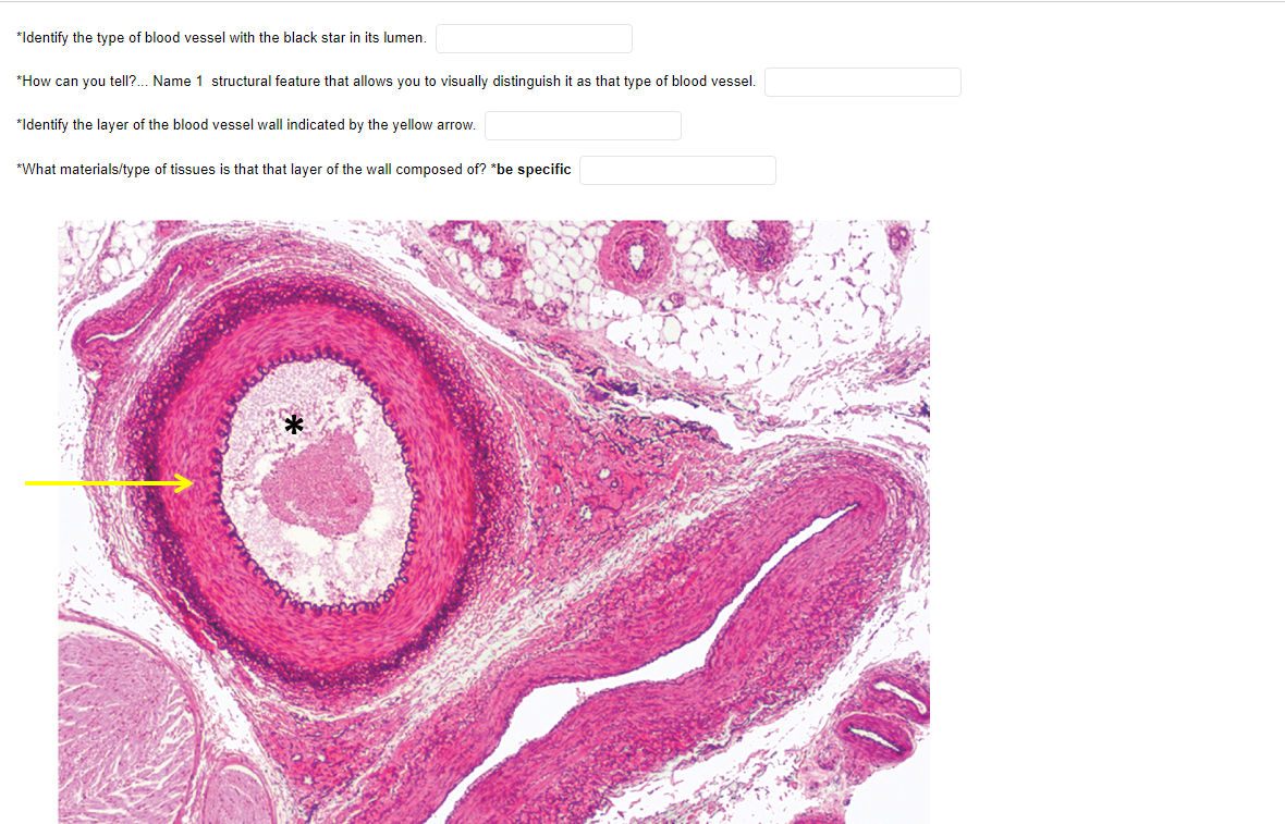 Solved *Identify the type of blood vessel with the black | Chegg.com