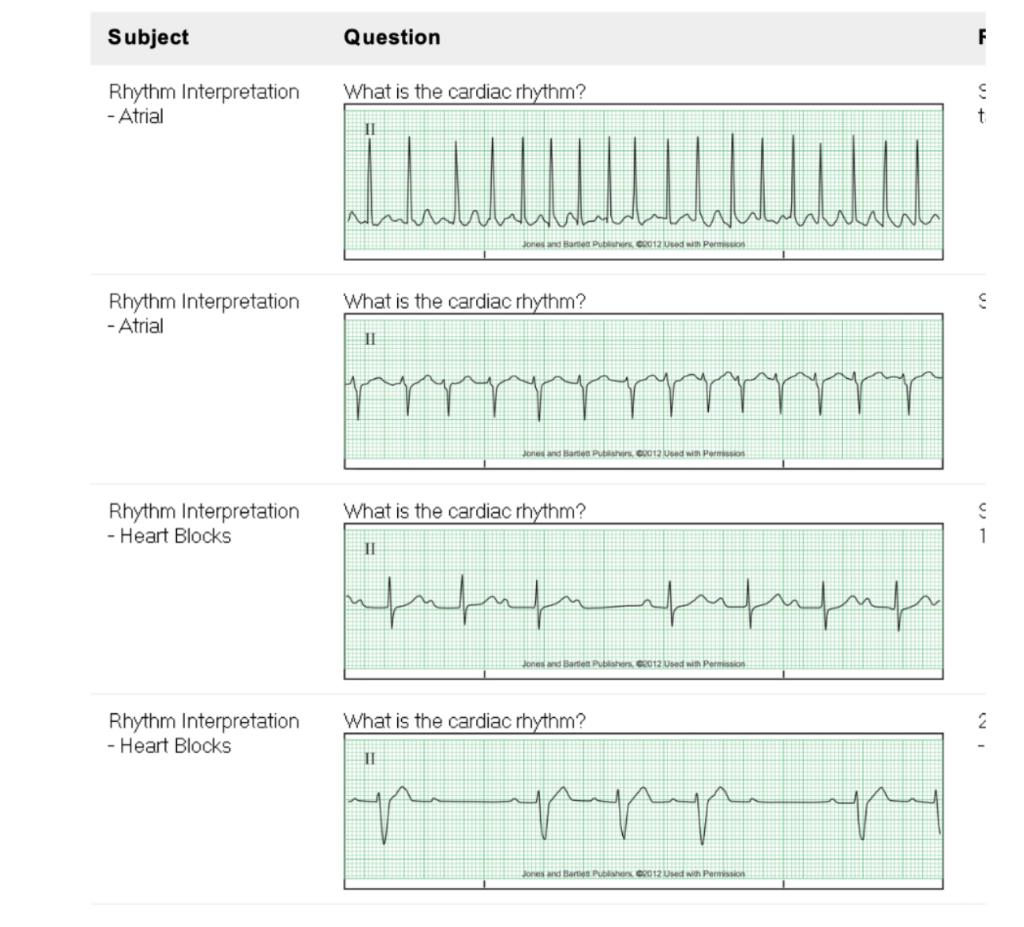 Solved Rhythm Interpretation - Atrial Rhythm Interpretation | Chegg.com