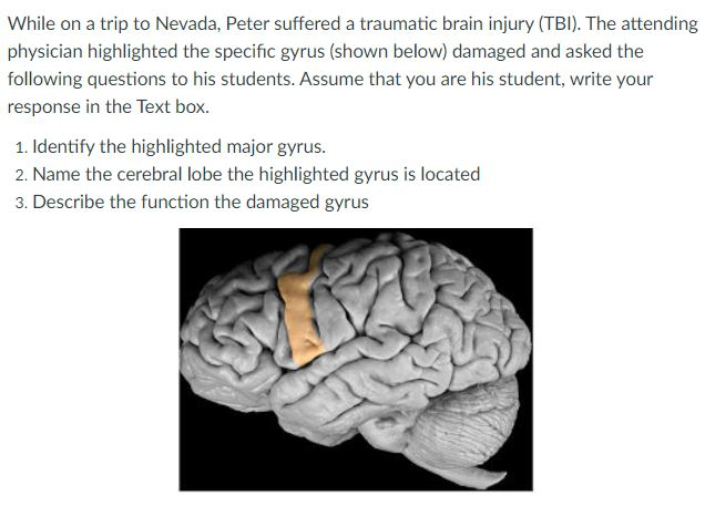 Solved While on a trip to Nevada, Peter suffered a traumatic | Chegg.com