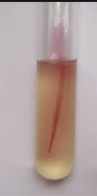 ervations and Results Nutrient Broth Nutrient Agar | Chegg.com