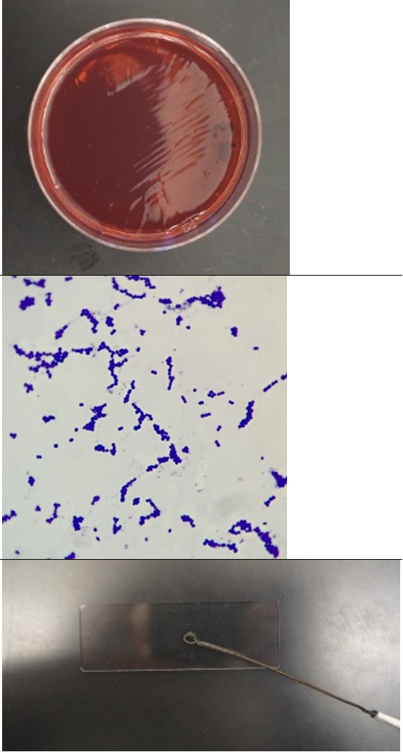 Solved I need help identifying the unknown bacterium, by | Chegg.com