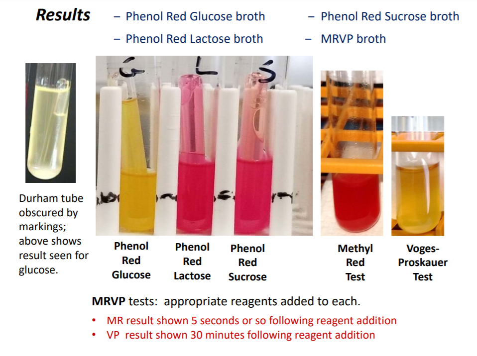 Solved ** I need help on interpretation section in the table | Chegg.com