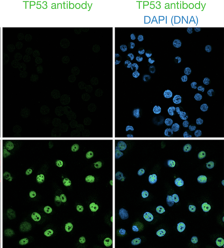 Solved TP53 Status - questions Describe the outcomes of the | Chegg.com