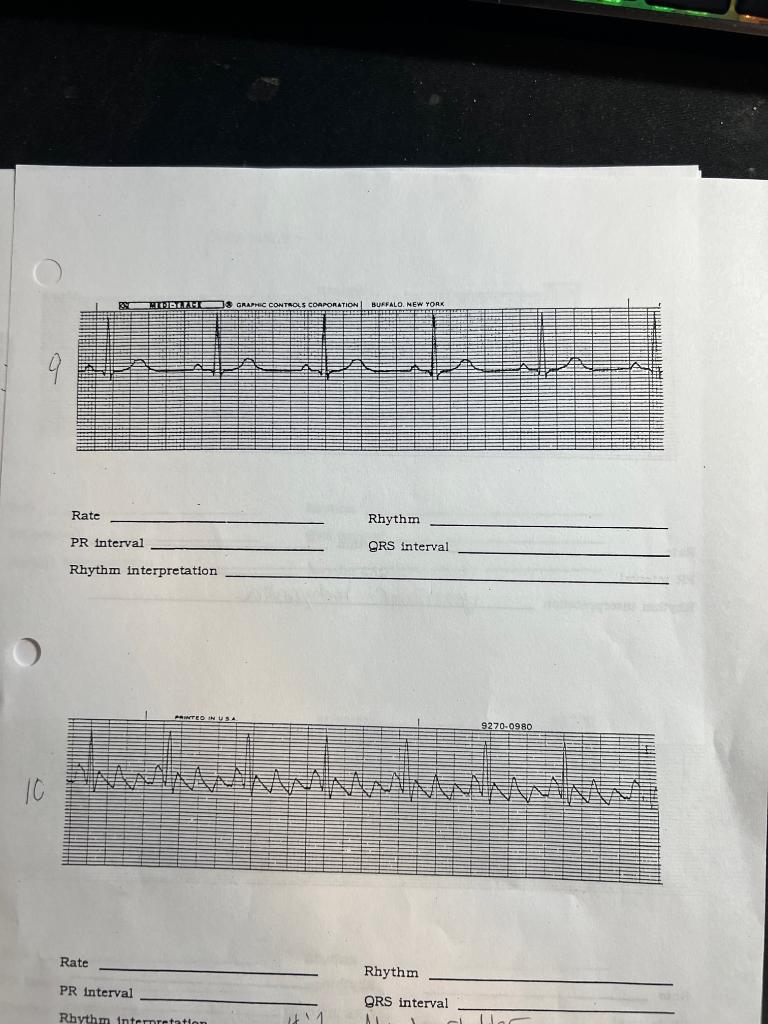 Solved Rate Rhythm PR interval QRS interval Rhythm | Chegg.com
