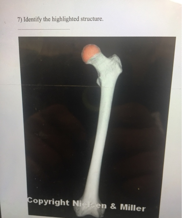 Solved 1) Identify the highlighted area of the following | Chegg.com