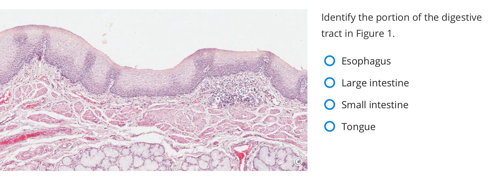Solved Identify the portion of the digestive tract in Figure | Chegg.com