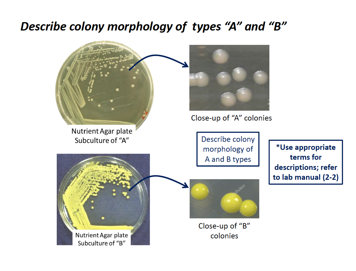 Solved Subculture and Colony | Chegg.com
