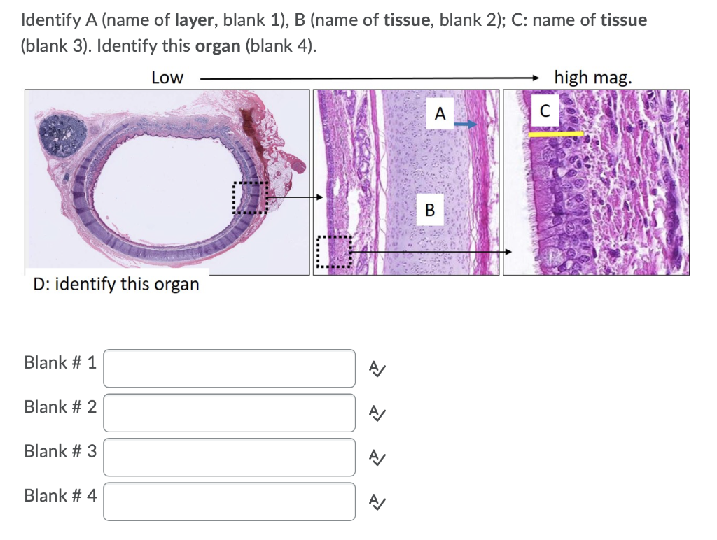 Solved Identify A (name of layer, blank 1), B (name of | Chegg.com