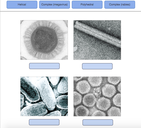 Solved Helical Complex (megavirus) Polyhedral Complex | Chegg.com