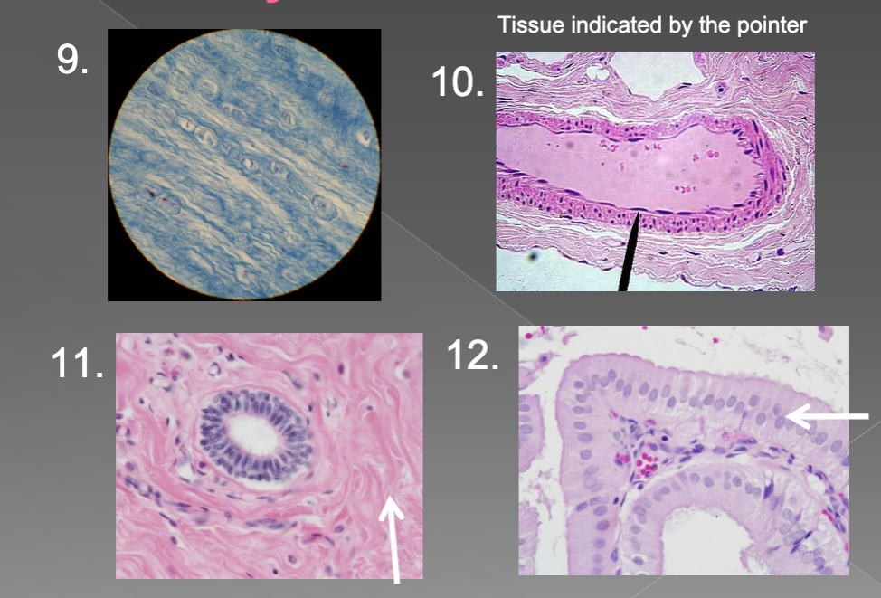 Solved 1.. 2. 3. 4. 5. 16. 7. 8.4 Tissue indicated by | Chegg.com
