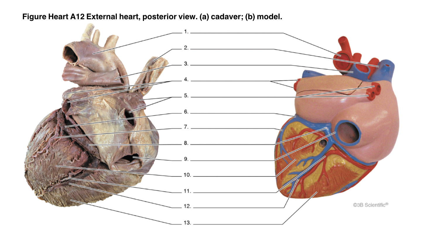 Solved Figure Heart A12 External heart, posterior view. (a) | Chegg.com